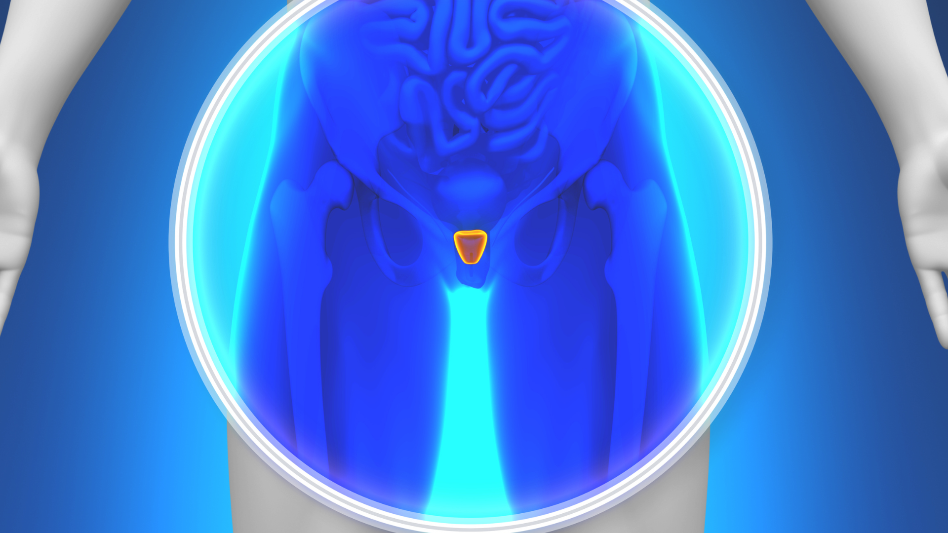 Ipertrofia prostatica e possibili approcci terapeutici - OmegaPharma